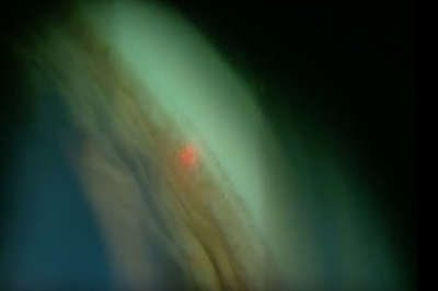 Ellex Tango YAG/SLT Laser - Insight Eye Equipment | Refurbished ...